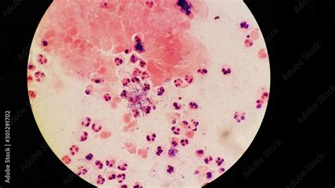 White Blood Cells On Slide Gram Stain Specimen Pleural 48 OFF