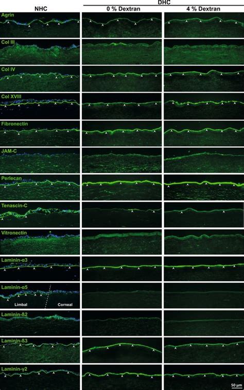 A Decellularized Human Corneal Scaffold For Anterior Corneal Surface