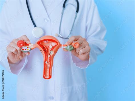 Doctor Holding Uterus And Ovaries Model Ovarian And Cervical Cancer Cervix Disorder