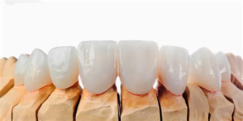 Regeneraci N Sea En Implantes Dentales Dc Dental Heredia