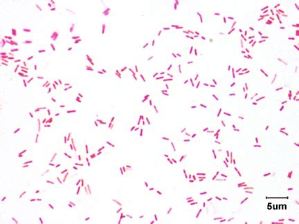 Biol Lab Manual Gram Stain Of Pseudomonas Aeruginosa