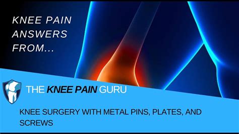 Knee Surgery With Metal Pins Plates And Screws By The Knee Pain Guru