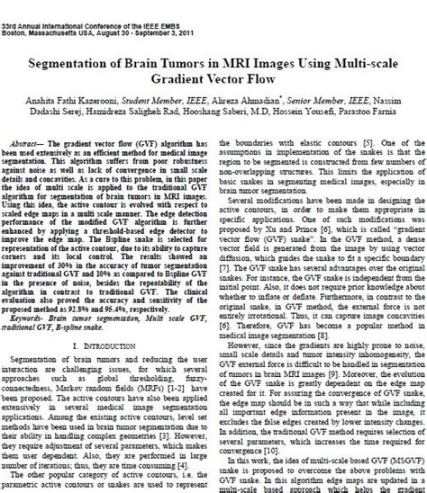 qmisg segmentation of brain tumors in mri images