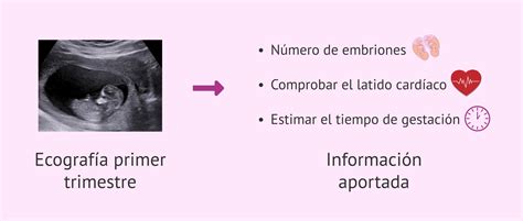 Al Cuanto Tiempo Se Puede Escuchar El Corazon Del Bebe Cheap Sale