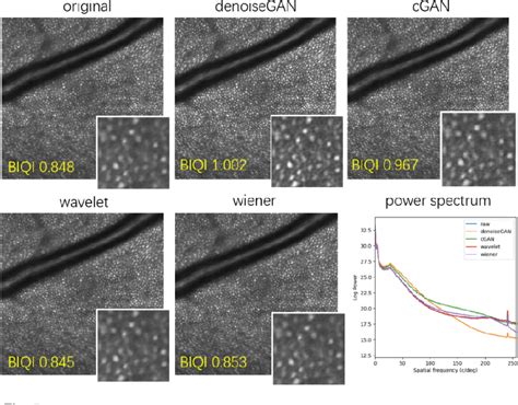 figure 3 from semi supervised generative adversarial learning for denoising adaptive optics