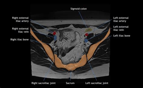 Pelvic Bone Anatomy Axial Human Anatomy