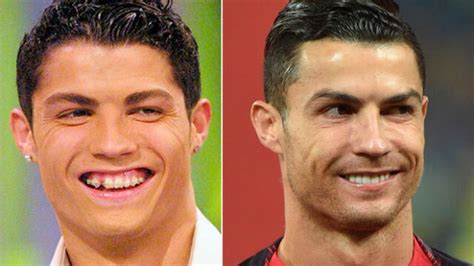 Cristiano Ronaldo Instagram antes y después del futbolista por el