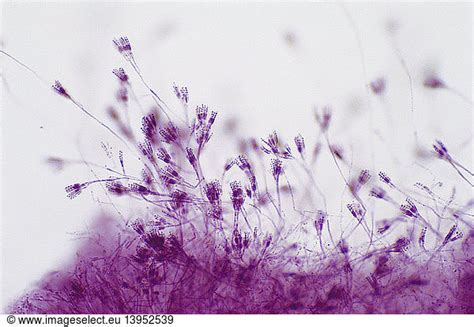 Penicillium Sp Conidia LM Penicillium Sp Conidia LM Ascomycete