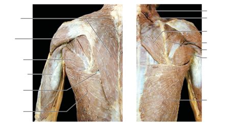 Lab Posterior View Of The Muscles Of The Thorax And Shoulder