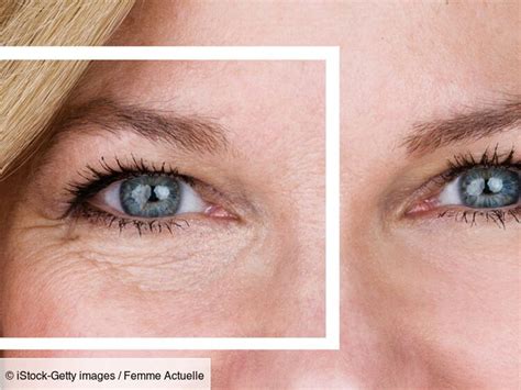 Nos solutions pour éliminer les poches sous les yeux Femme Actuelle
