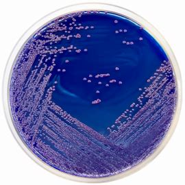 Agar Bilis Verde Brillante Formato 500 G