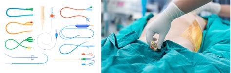 Sonda Vesical Qué Es Y Qué Tipos Existen Salud Savia 53 OFF