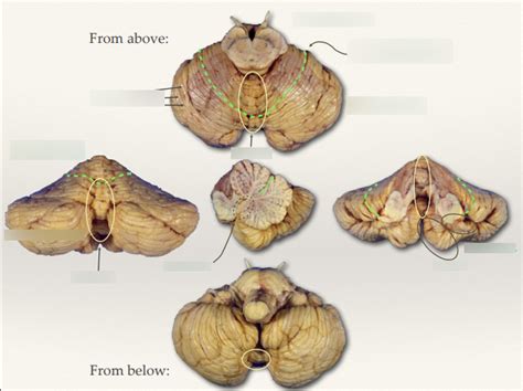 Cerebellum Part Diagram Quizlet