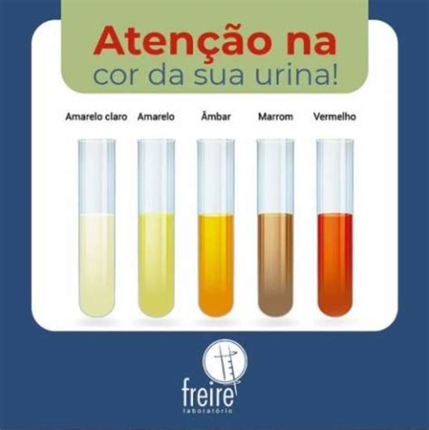 Atenção na cor da sua urina labfreire