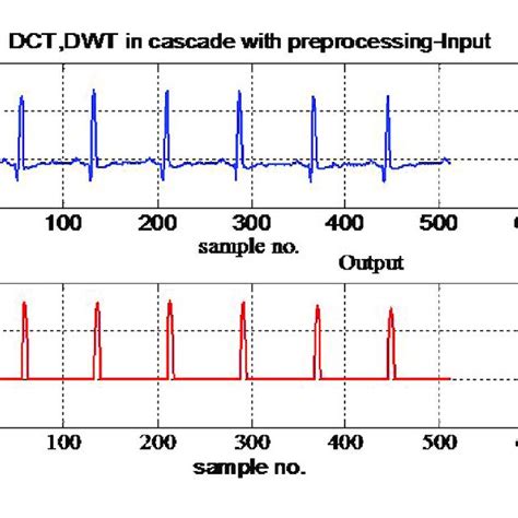 pdf ecg signal compression using parallel and cascade method for qrs complex
