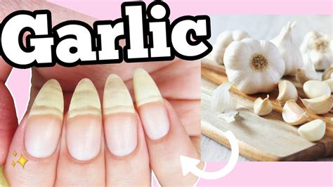 How To Grow Your Nails Fast With Garlic 4 Different Ways YouTube