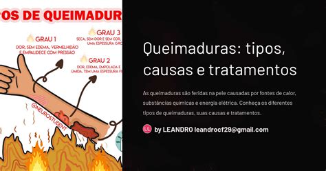 Queimaduras Tipos Causas E Tratamentos