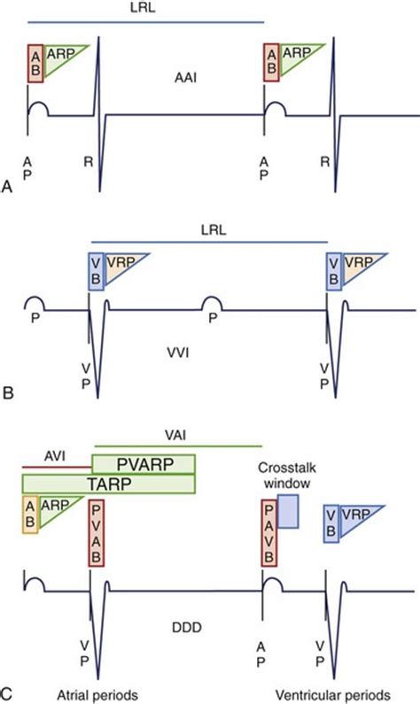 Cardiac Pacing Modes And Terminology Clinical Gate
