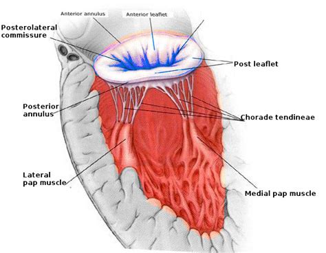 Figure Mitral Valve Anatomy Image Courtesy S Bhimji MD StatPearls