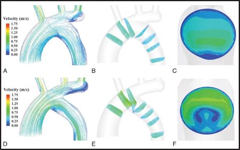 computational fluid dynamic model velocities a c represent the download scientific diagram