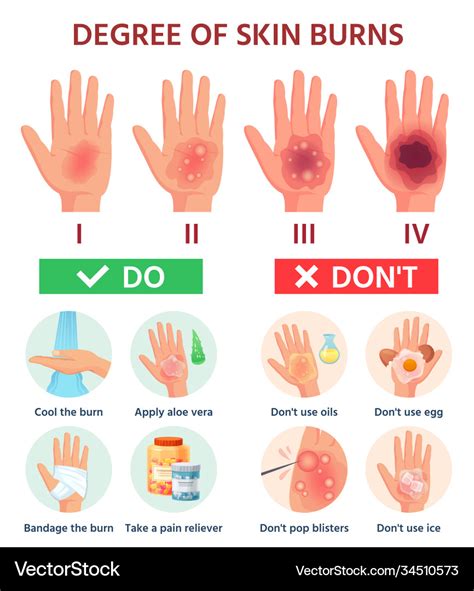 Burns Degree First Aid For Burn Wound Fire Vector Image