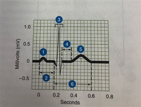 Section Of A Normal Ecg Lead Ii Diagram Quizlet