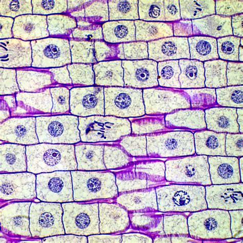 Stages Of Mitosis In Onion Root Tip