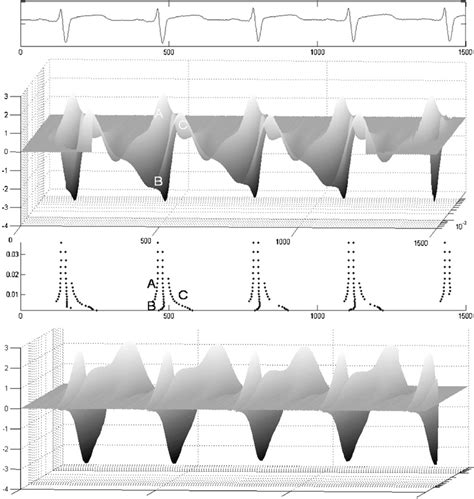 continuous wavelet transform of a 3 s signal using the mexican hat cwt download scientific