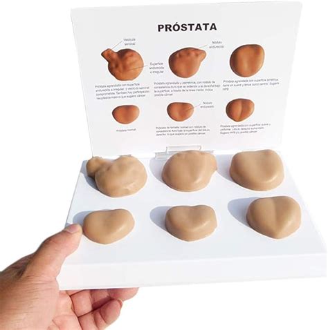 Männliche Kontrast Pathologische Pathologische Prostata Anatomie Modell