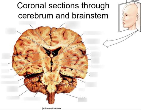 Coronal Section Diagram Quizlet