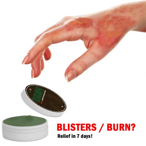 NEW QUALITY BRIM Advance Treatment For Human And Pets Skin Burn