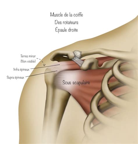 Tendinopathie De La Coiffe Rompue Dr El Sair