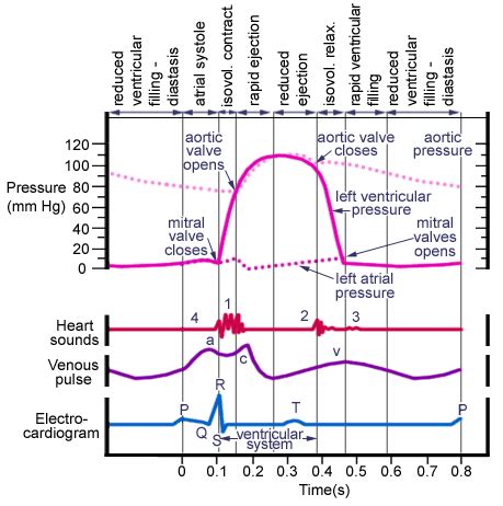 Wiggers Diagram Aortic Regurgitation