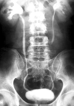 Ipap Radiology Exam Intro To Radiology Flashcards Quizlet