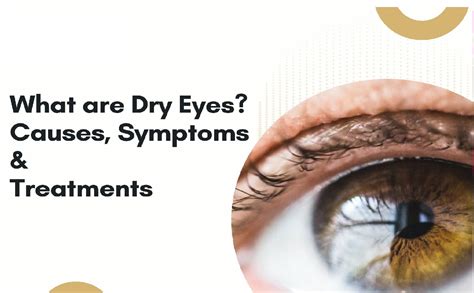 What Is Dry Eye Syndrome Causes Symptoms And Treatment SARKARI LIBRARY