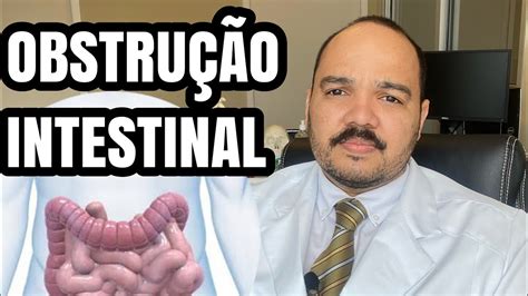 OBSTRUÇÃO INTESTINAL o que é SINTOMAS CAUSAS e TRATAMENTO CLÍNICO E