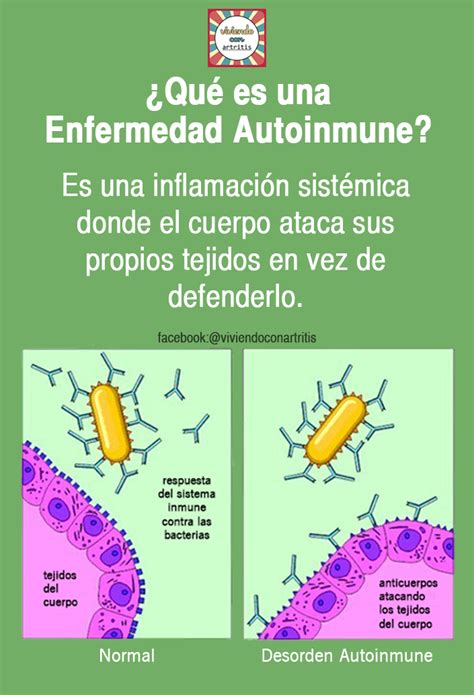 Viviendo Con Artritis Qu Es Una Enfermedad Autoinmune