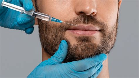 Preenchimento labial masculino como é feito quais os resultados e preço