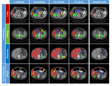 figure 2 from federated multi organ segmentation with partially labeled data semantic scholar