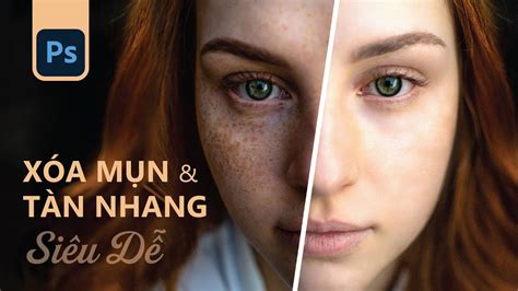 Xóa mụn và tàn nhàng siêu dễ Photoshop quan design xoa mun