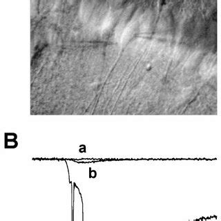 Whole Cell Patch Clamp Recording From CA1 Pyramidal Cells A The