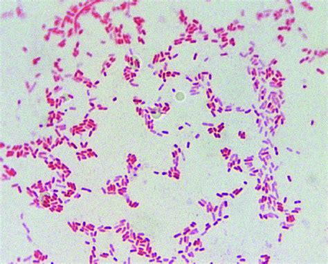 100 E Coli Morphology Gram Stain 283207ecoli Gram Stain Morphology