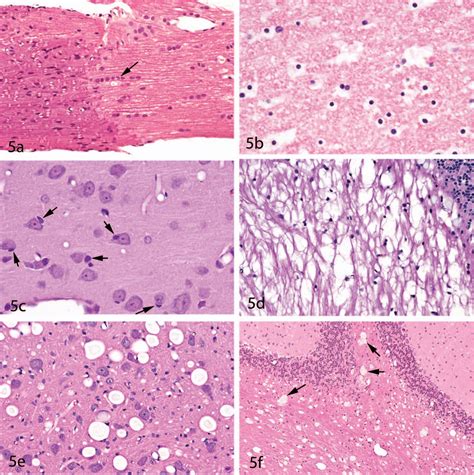 Nerve Histology