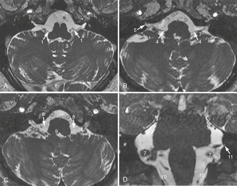 Cranial Nerves Radiology Key
