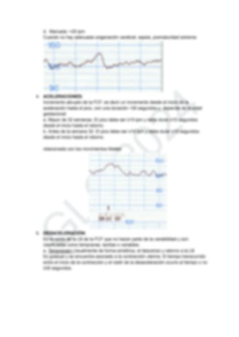 SOLUTION Pruebas De Bienestar Fetal Monitoria Fetal Studypool