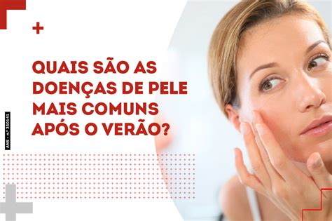 Quais são as doenças de pele mais comuns após o verão Paraná Clínicas