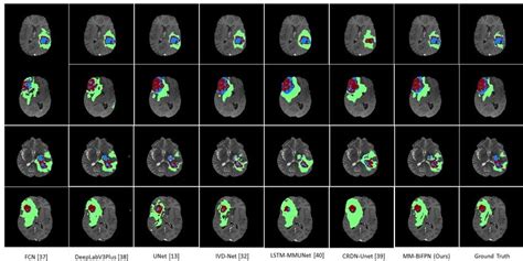visualization performance of the mri brain segmentation results with download scientific