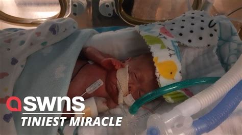 World S Most Premature Baby Born Reaches His First Birthday And Learns