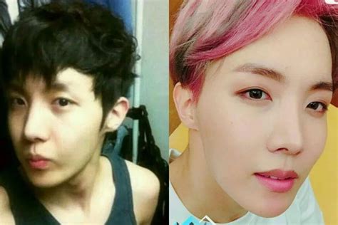 Did BTS Get Any Plastic Surgery