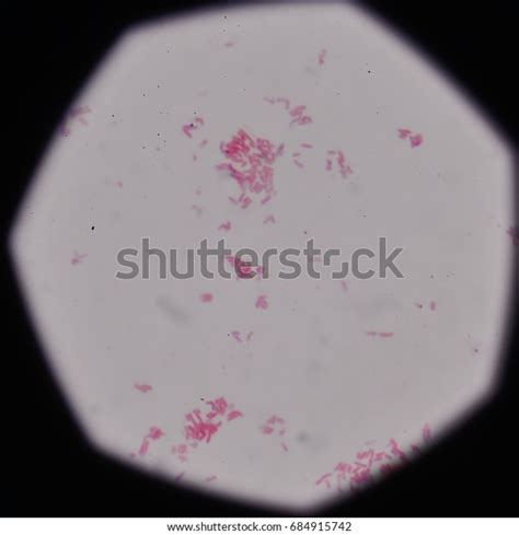 Gram Staining Called Grams Method Method Stock Photo